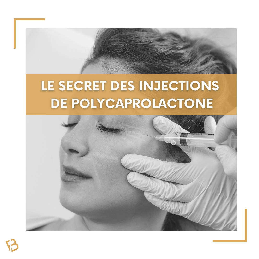 Le Secret des Injections de Polycaprolactone : Rajeunir le visage sans ...